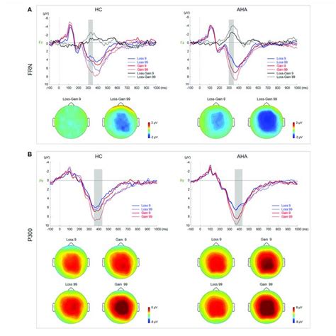 Waveforms And Scalp Topographies Of Spn A Grand Average Erp Download Scientific Diagram