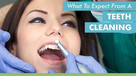 What Does Cleaning Teeth Do At Lea Blackburn Blog