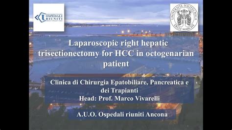 Marco Vivarelli On Linkedin Laparoscopic Right Hepatic