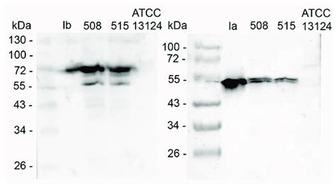 Production Of Iota Toxin In C Perfringens 508 17 508 515 17 515 Download Scientific