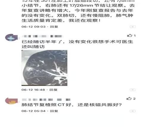 CT胸片和磁共振肺结节复查时哪个检查效果既好又安全 科普头条 看呼吸