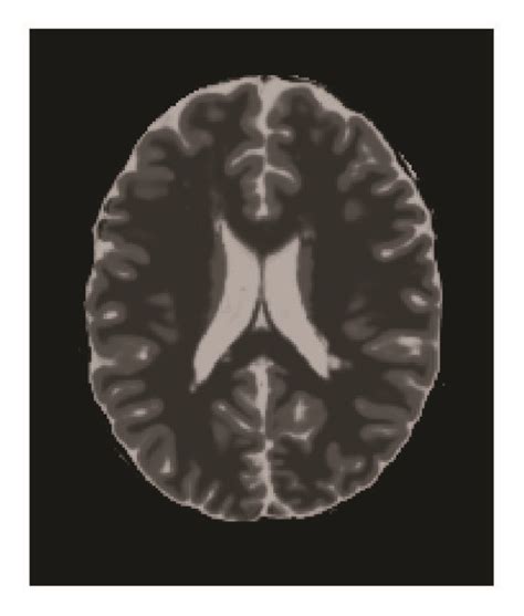 Extracted Independent Components By Fastica Algorithm A To C Download Scientific Diagram
