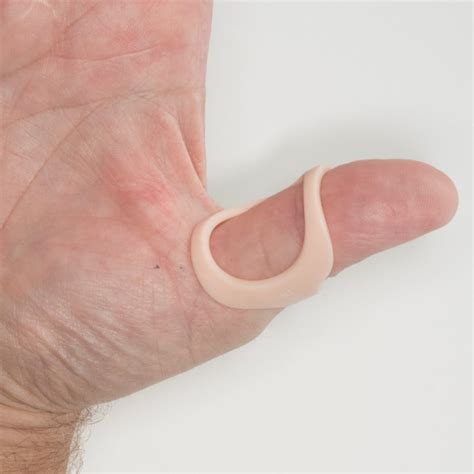 Treating Trigger Thumb With An Oval 8 Finger Splint Updated 43 Off