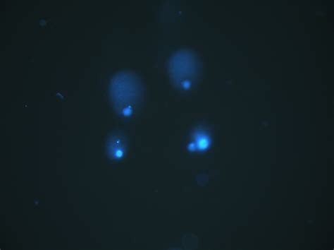 Comet Assay High Variability Researchgate