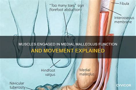 Muscles Engaged In Medial Malleolus Function And Movement Explained Cyvigor