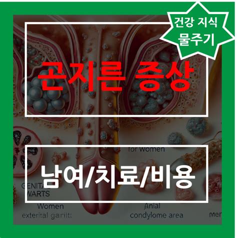 남자 여자 곤지름 검사 치료비용 항문 곤지름 증상 원인 가려움 Hpv 바이러스 네이버 블로그