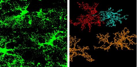 Neurons Lead The Way In The Development Of Astrocytes