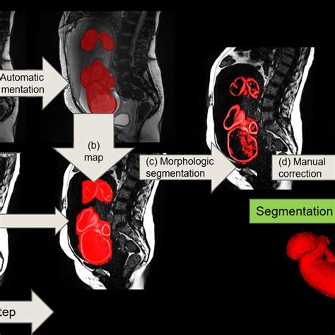 Automatic Fetal Fat Segmentation The Inputs Light Blue Are Fat Only