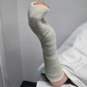 Volar Ulnar Gutter Splint Plaster Room