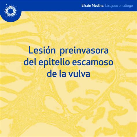 Neoplasia Intraepitelial Vulvar NIV Cáncer y Oncología Medina