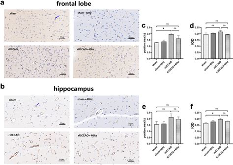 Light Flicker Stimulation At 40 Hz Does Not Increase Angiogenesis In