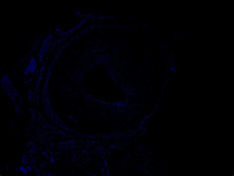 Colocalization Analysis Warning Messages Image Analysis Image Sc Forum