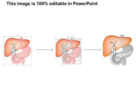 Biliary System Medical Images For PowerPoint PowerPoint Presentation Templates PPT