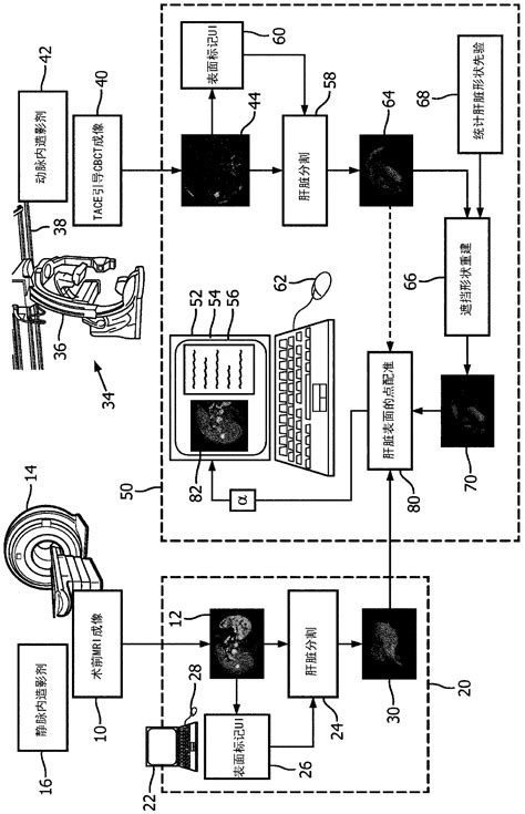 Cbct To Mr Registration Via Occluded Shape Reconstruction And Robust Point Matching Eureka