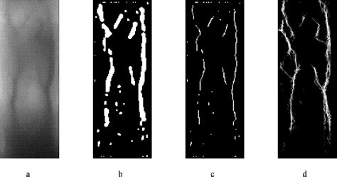 Low Quality Finger Vein Image Enhancement Method Eureka Patsnap