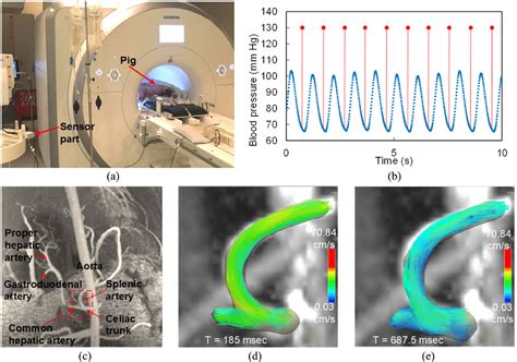 Figure 3 From Design Of A Low Cost Self Adaptive And Mri Compatible Cardiac Gating System