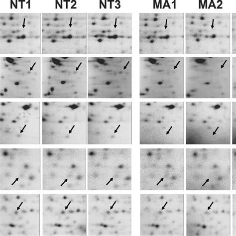 String Analysis Performed With Differentially Regulated Proteins Aldoa