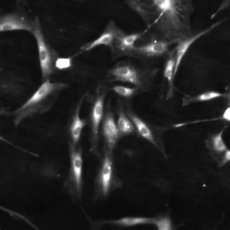 1024 Cell Detection Proliferation Edition Object Detection Dataset By Msu