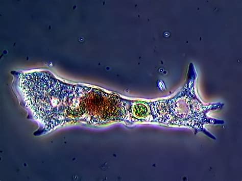 Amibe Rhizopodes And Actinopodes Mikroscopia