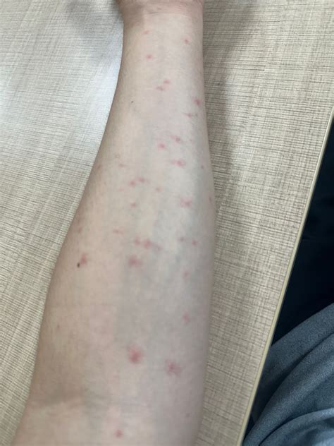 산책갔다온 강아지 목욕갔다가 팔에 뭐가 났는데 뭔가요 지식in