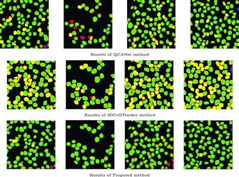 Comparison Of Segmentation Results By Reference Methods And The
