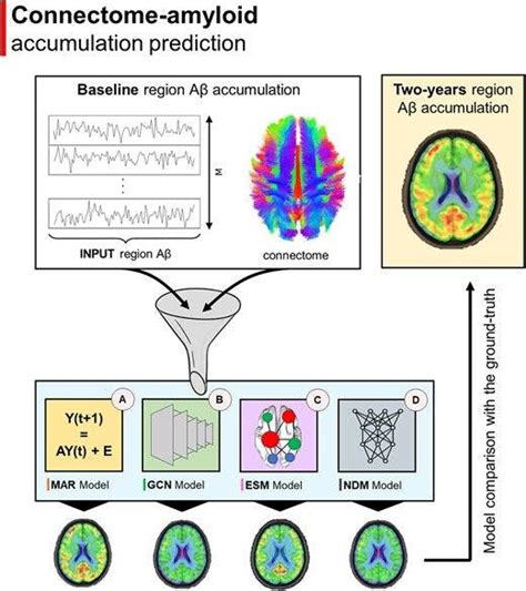 Revolutionizing Alzheimers Disease Prognisis With Machine Learning