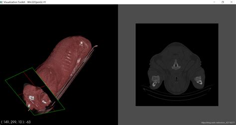 01 Vtk体绘制（volume Rendering） Vtkimageplanewidget交互显示横截面vtk Stl 显示二维切面图 Csdn博客