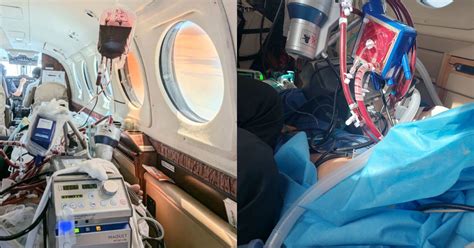 Best Ecmo Transfer Service Your Step By Step Preparation Guide