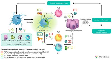 Plaque Psoriasis Pathophysiology At Ada Michalski Blog