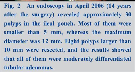 An Endoscopy In April 2006 14 Years After The Surgery Revealed