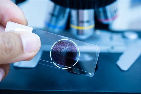 Disease Prevention Do I Need To Have A Pathology Test