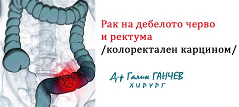 Д р Галин ГАНЧЕВ хирург Рак на дебелото черво и ректума колоректален карцином