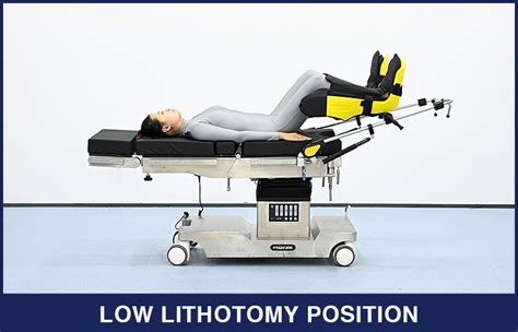 Lithotomy Position In Surgery