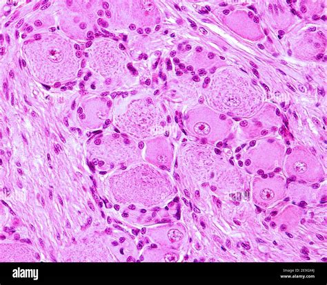 Unipolar Neuron Under Microscope