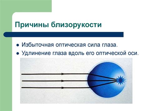 Дефекты зрения презентация онлайн