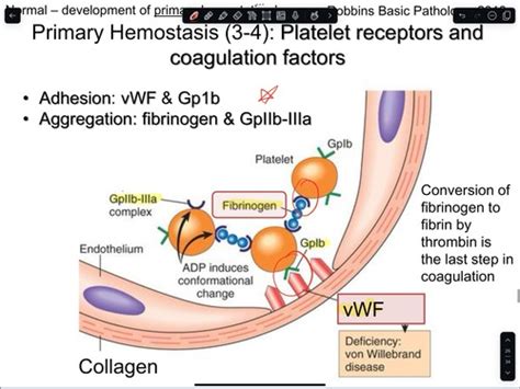 Abnormalities Of Hemostasis Flashcards Quizlet