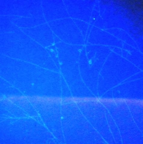 Arthrobotrys Dactyloides
