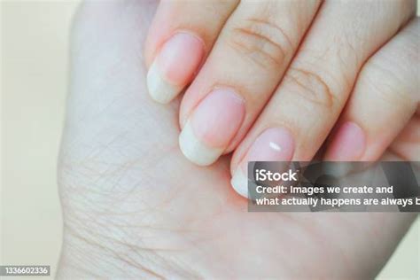 여성의 손톱에 흰색 반점 또는 루코니치아 펑크 타타는 건강 문제의 출현을 보여줍니다 비타민에 대한 스톡 사진 및 기타 이미지 비타민 손톱 마그네슘 Istock