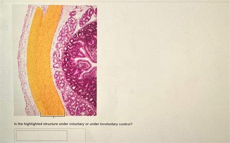 Solved Identify The Highlighted Structures Identify The