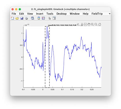 Preprocessing Of Optically Pumped Magnetometer Opm Data Fieldtrip