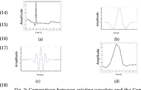 Figure 2 From Construction Of Wavelet Using M Estimation And Its Application In R Peak Detection