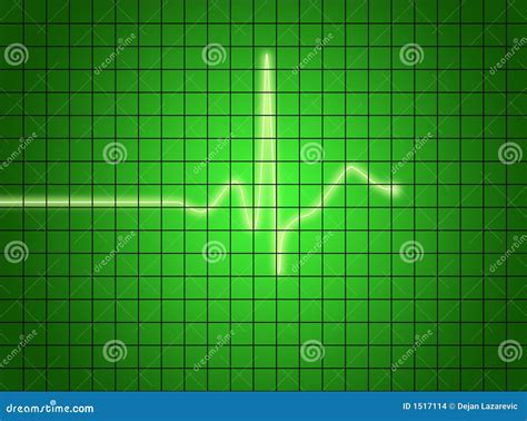 Ekg Signal Stock Illustration Illustration Of Design 1517114