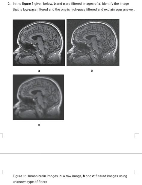 Solved 2 In The Figure 1 Given Below B And C Are Filtered
