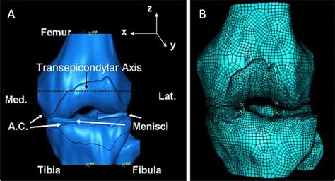 A Three Dimensional Geometry Of The Left Knee Which Includes Femur Download Scientific