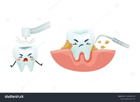 Dental Calculus