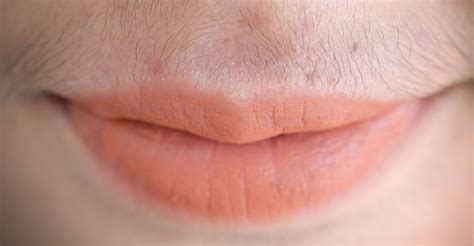 মুখের লোম দূর করার ঘরোয়া উপায়