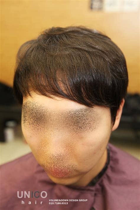 20대 머리숱 없는 남자 헤어 탈모 헤어스타일 가늘고 힘없는 머리 스타일 네이버 블로그