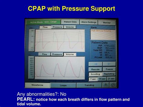 Ppt Ventilator Waveforms Basic Interpretation And Analysis Powerpoint Presentation Id 9090453