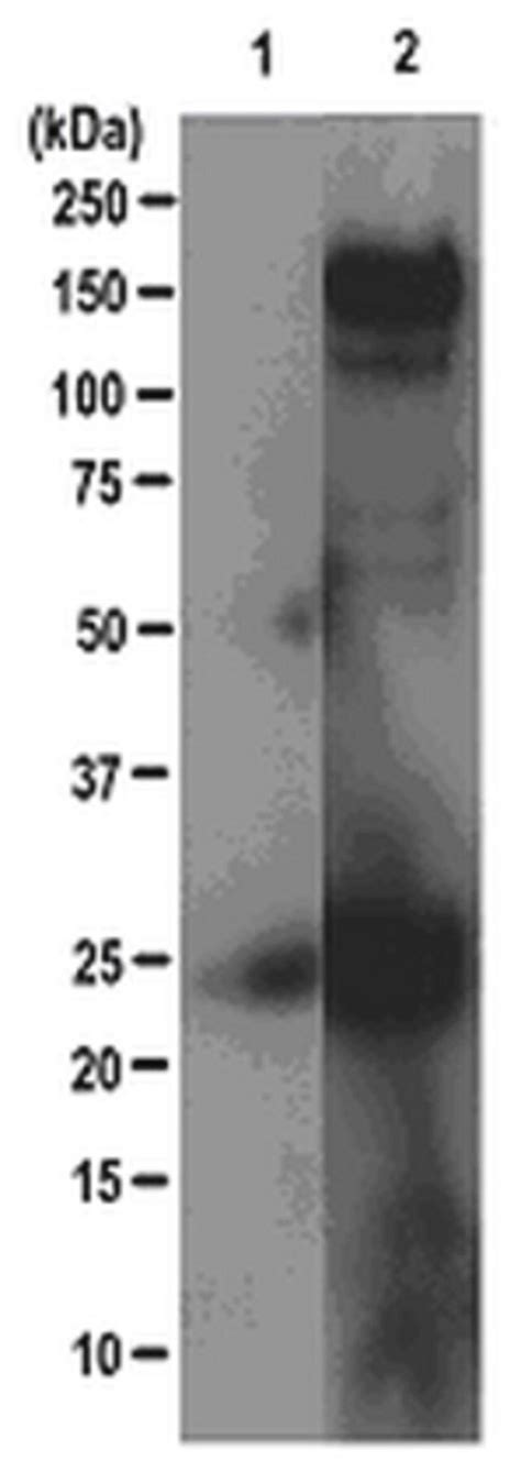 Anti Phosphotyrosine Antibody Clone 4g10® Magnetic Bead Conjugate