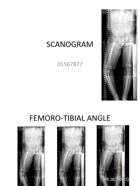 Scanogram Pdf